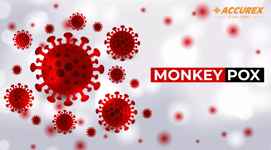 Monkeypox Symptoms & Signs | Accurex Biomedical Pvt. Ltd